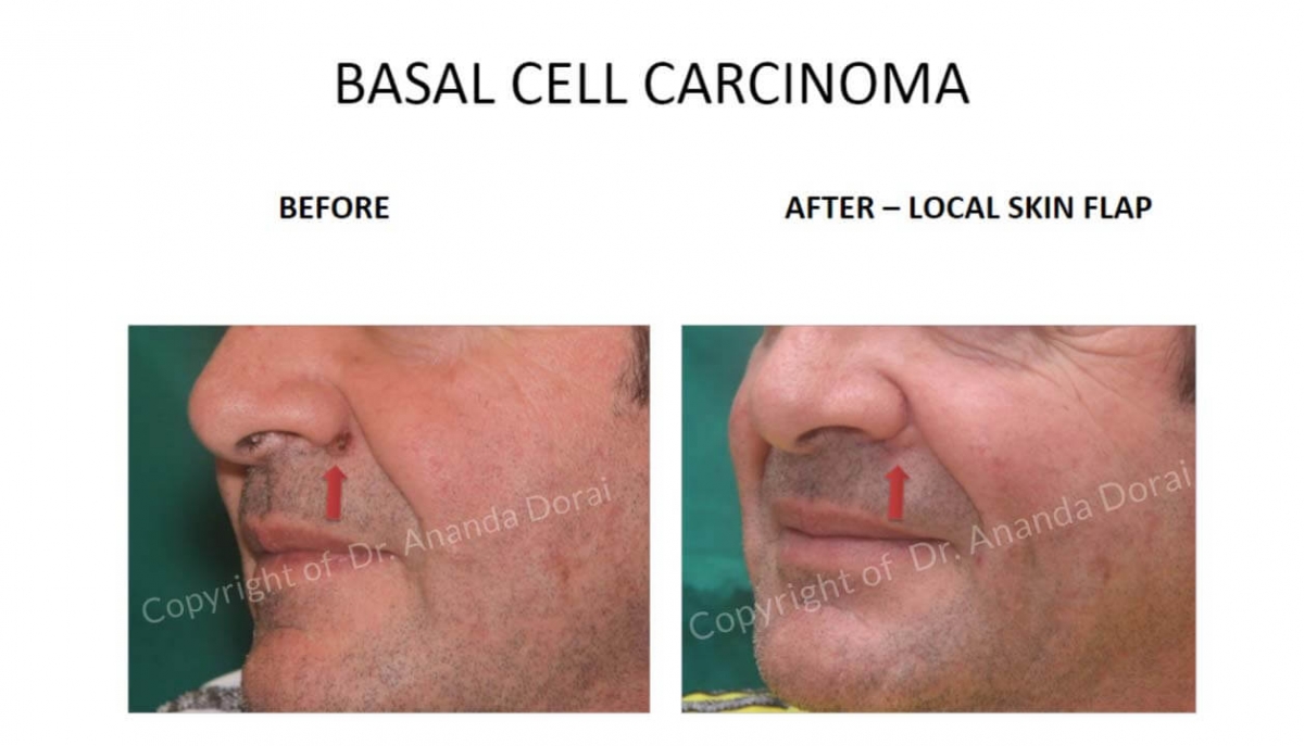 Before & After - Cosmetic Surgery & Plastic Surgeon